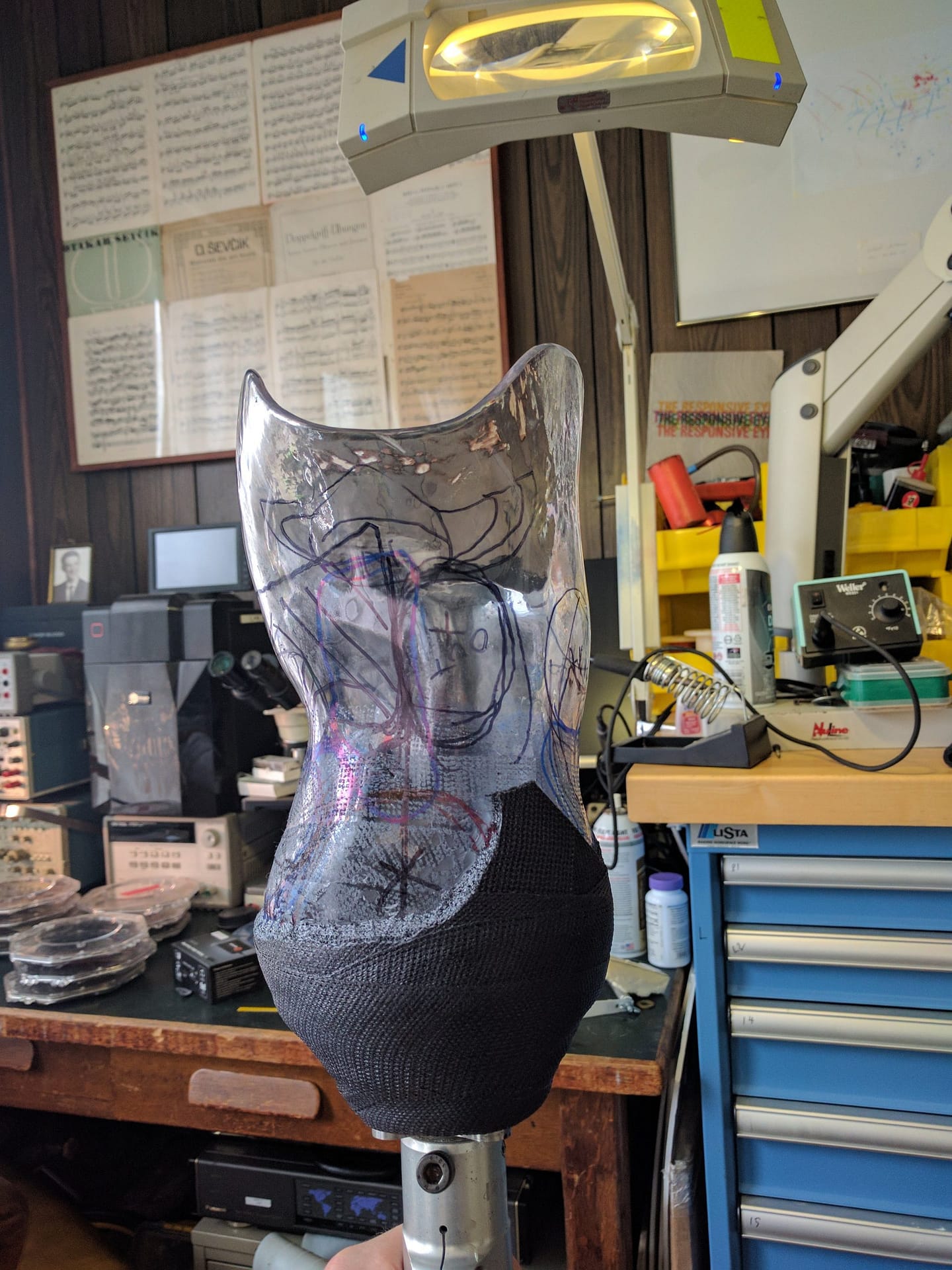 Non-bony musculature lock: Interface – M. Everett Lawson