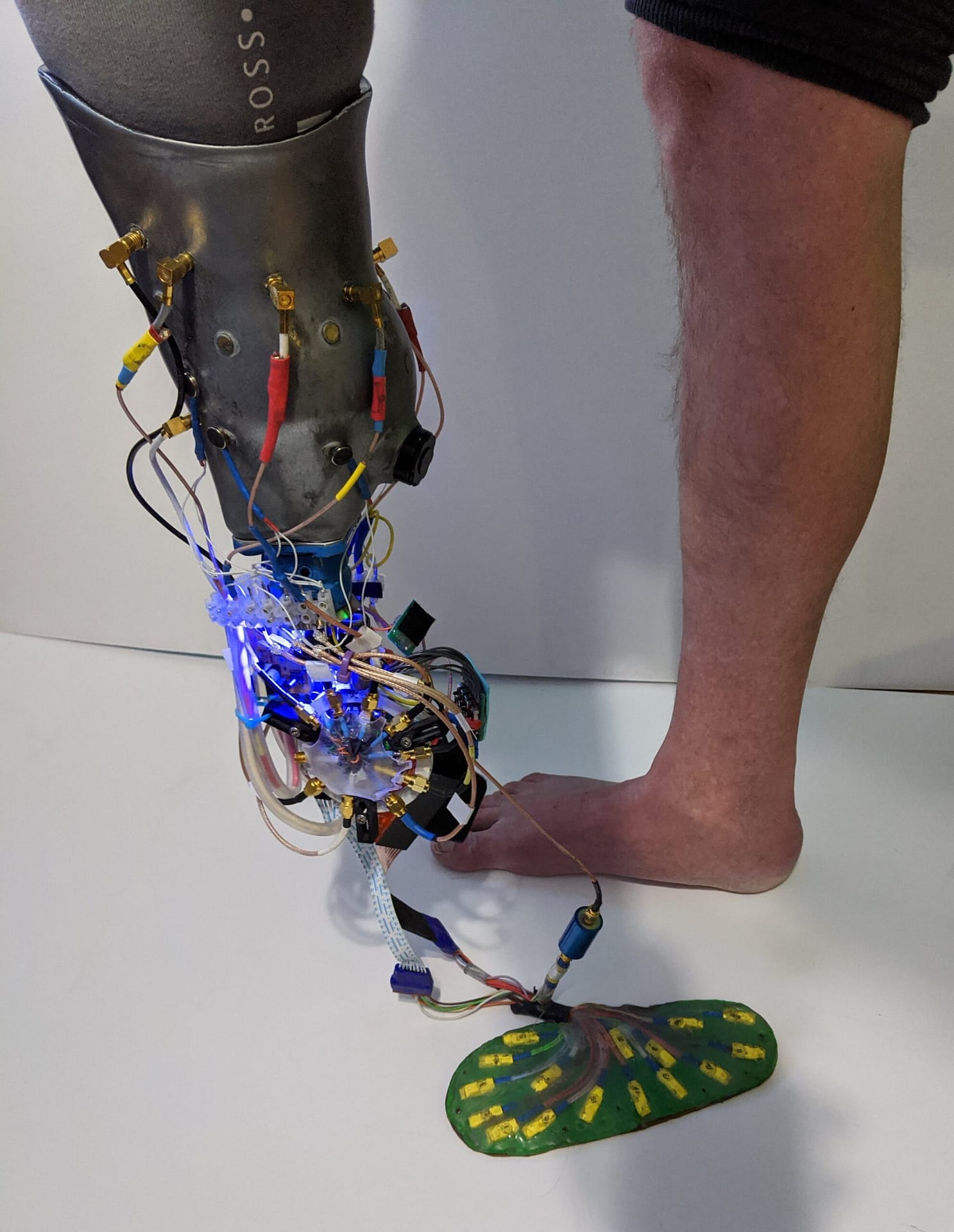 Synthetic nervous system: neuromuscular feedback mechanism – M. Everett ...